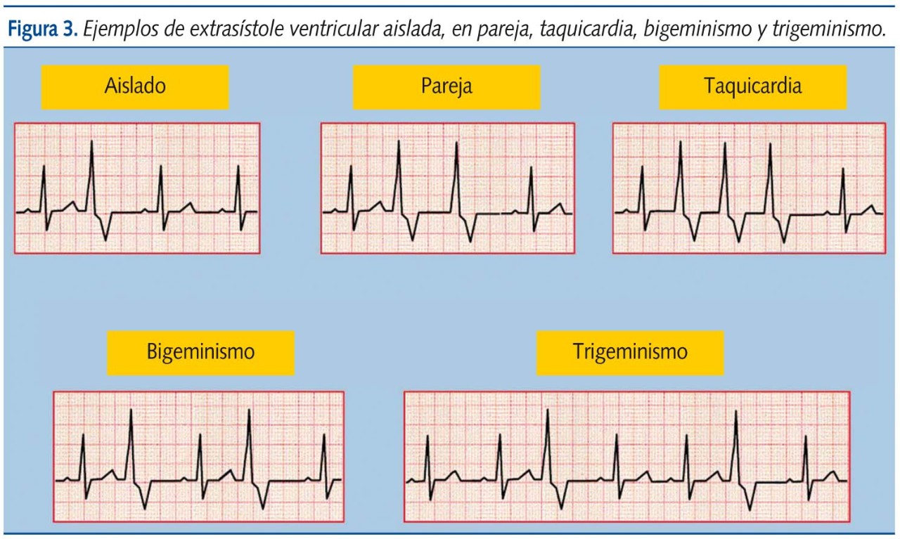 Digitálicos - Glicosídeos Cardioativos :: Enfarmacool